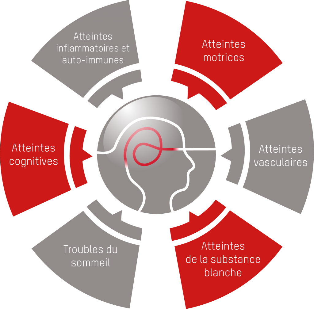 Présentation et missions de BRAIN-TEAM | BRAIN-TEAM